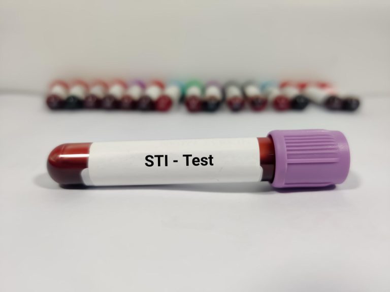 STD Testing in Helena, MT | Sage Medical Clinic